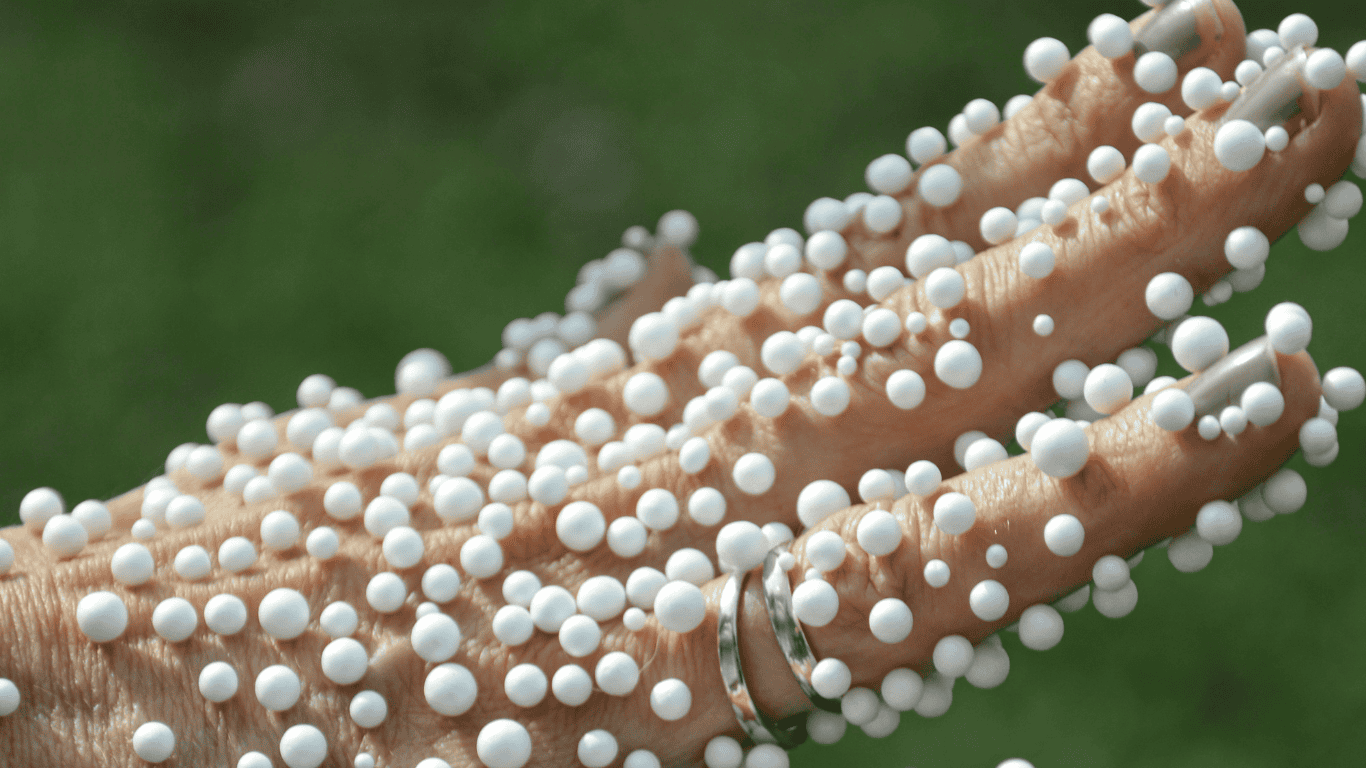 Can hemorrhoids spread to other parts of the body? - Heal Your Hemorrhoids